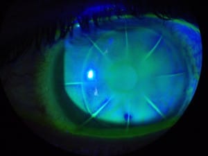 Dr. Edward Boshnick - Corneal Refractive Therapy Expert