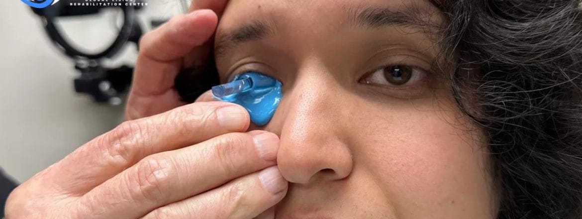 Power Of Scleral Lenses Transforming Keratoconus Treatment