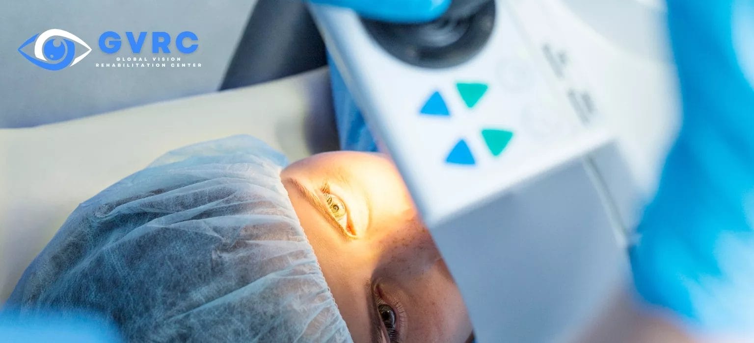 LASIK Complications and Scleral Lenses: An In-depth Guide