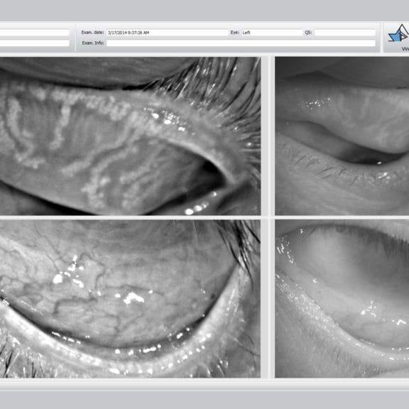 Dr. Edward Boshnick - Eye Print Pro & Scleral Lenses Expert