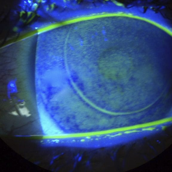 Dr. Edward Boshnick - Eye Print Pro & Scleral Lenses Expert